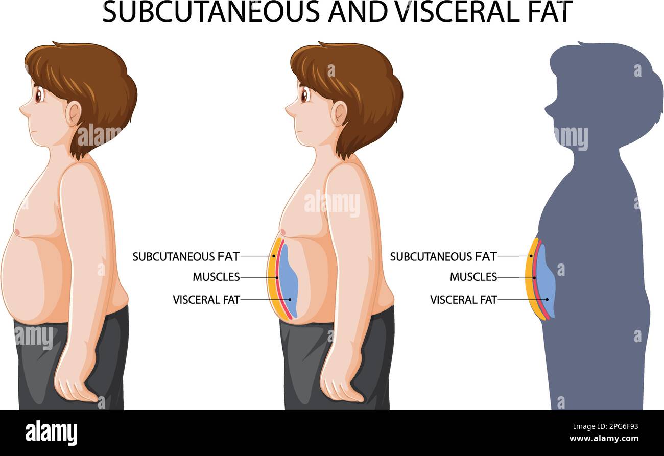 Subcutaneous and visceral fat diagram illustration Stock Vector Image ...