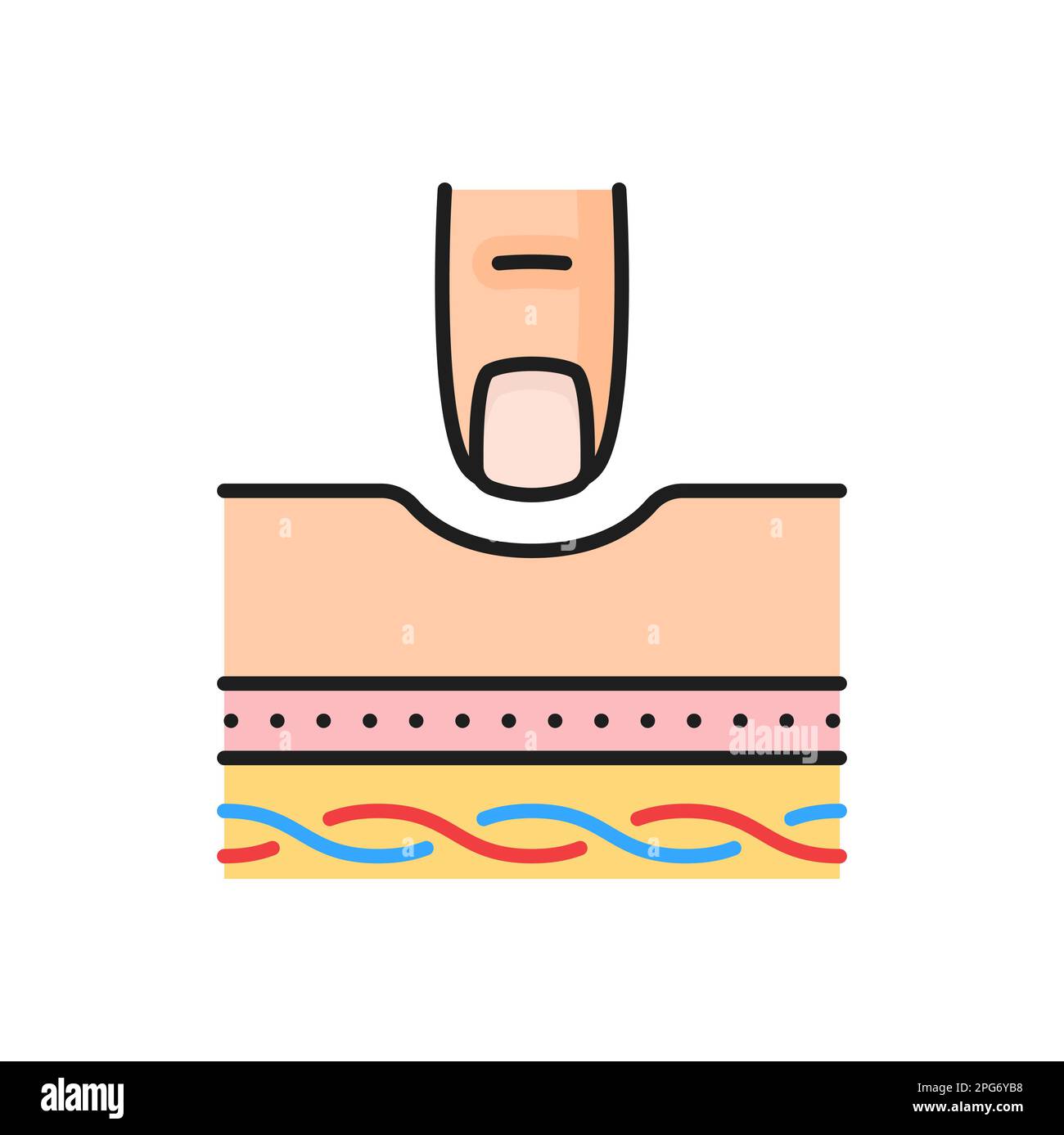 Abnormal blood flow, thrombosis and cardiovascular disease color line ...