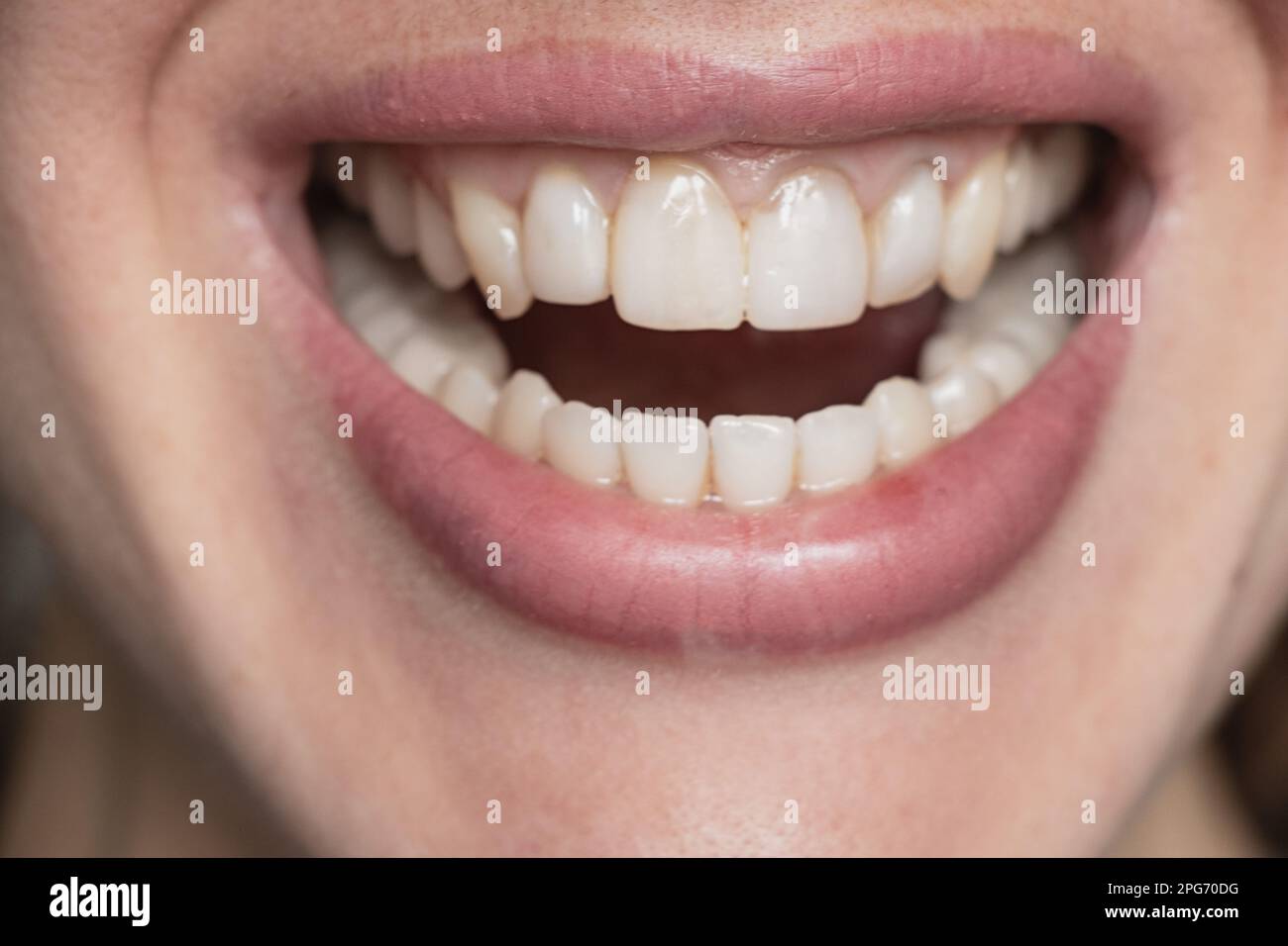 Female teeth hi-res stock photography and images - Alamy