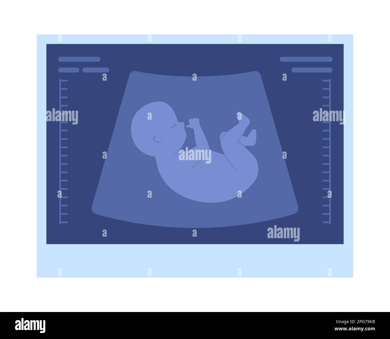 Fetal ultrasound Stock Vector Images - Alamy