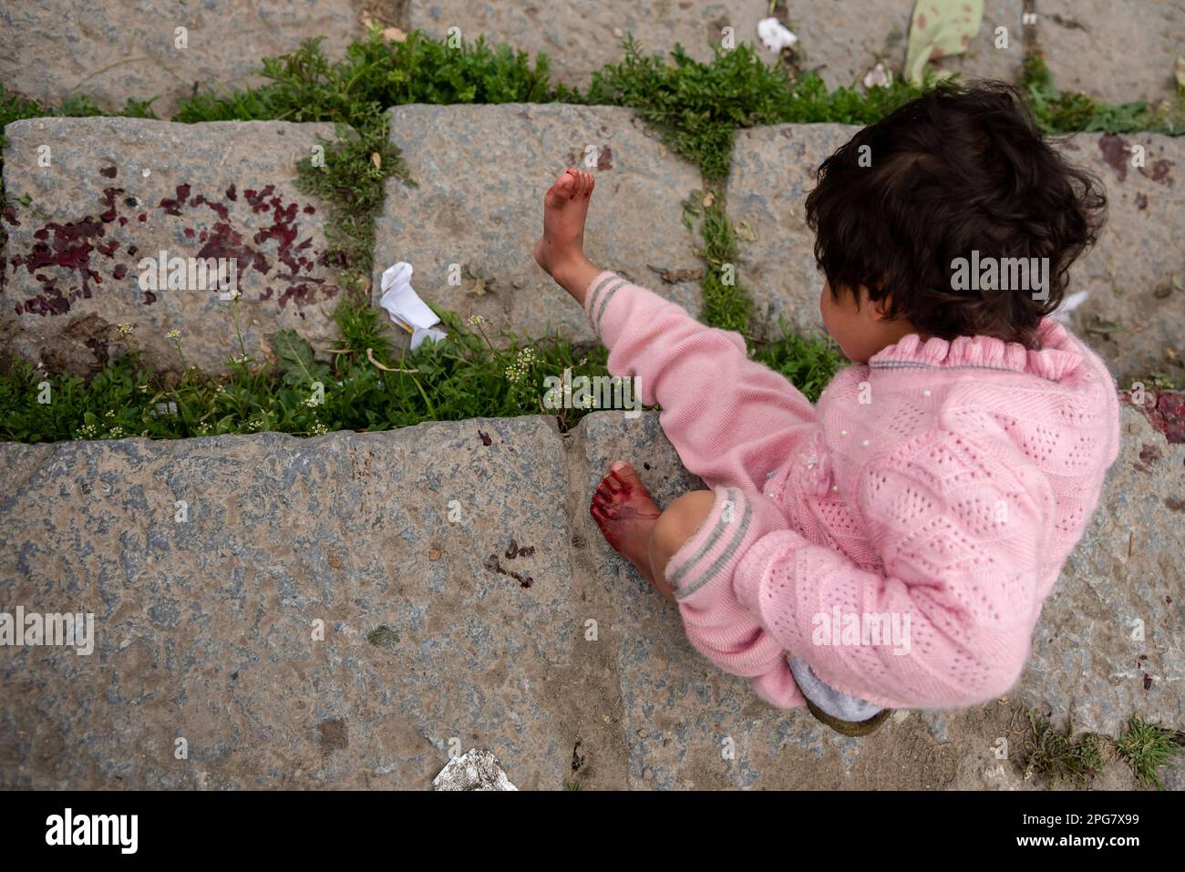 Srinagar, India. 21st Mar, 2023. A kid looks at the blood coming out of ...