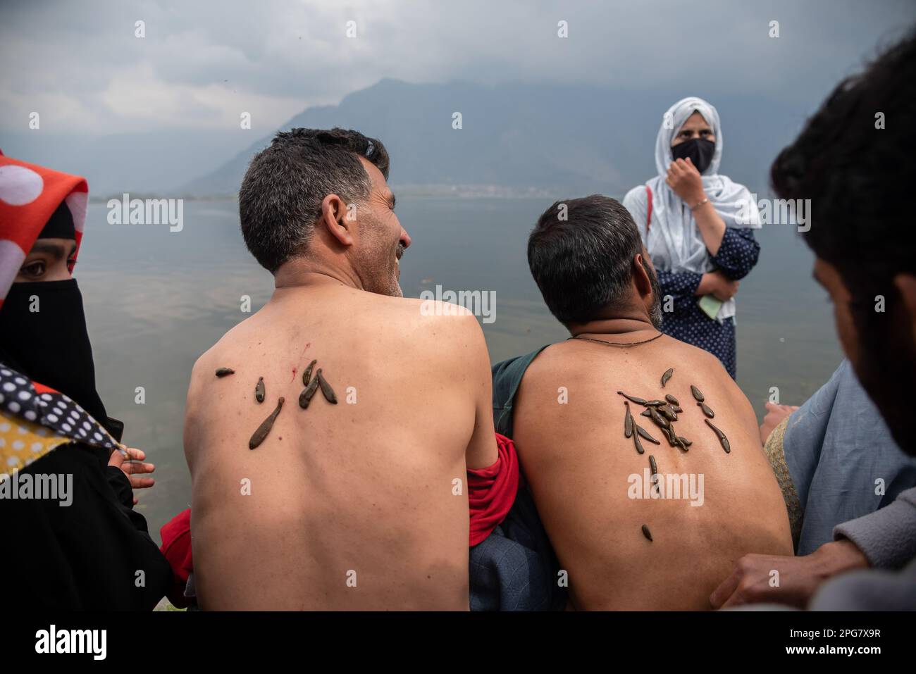 Srinagar, India. 21st Mar, 2023. Kashmiri residents receive leech ...