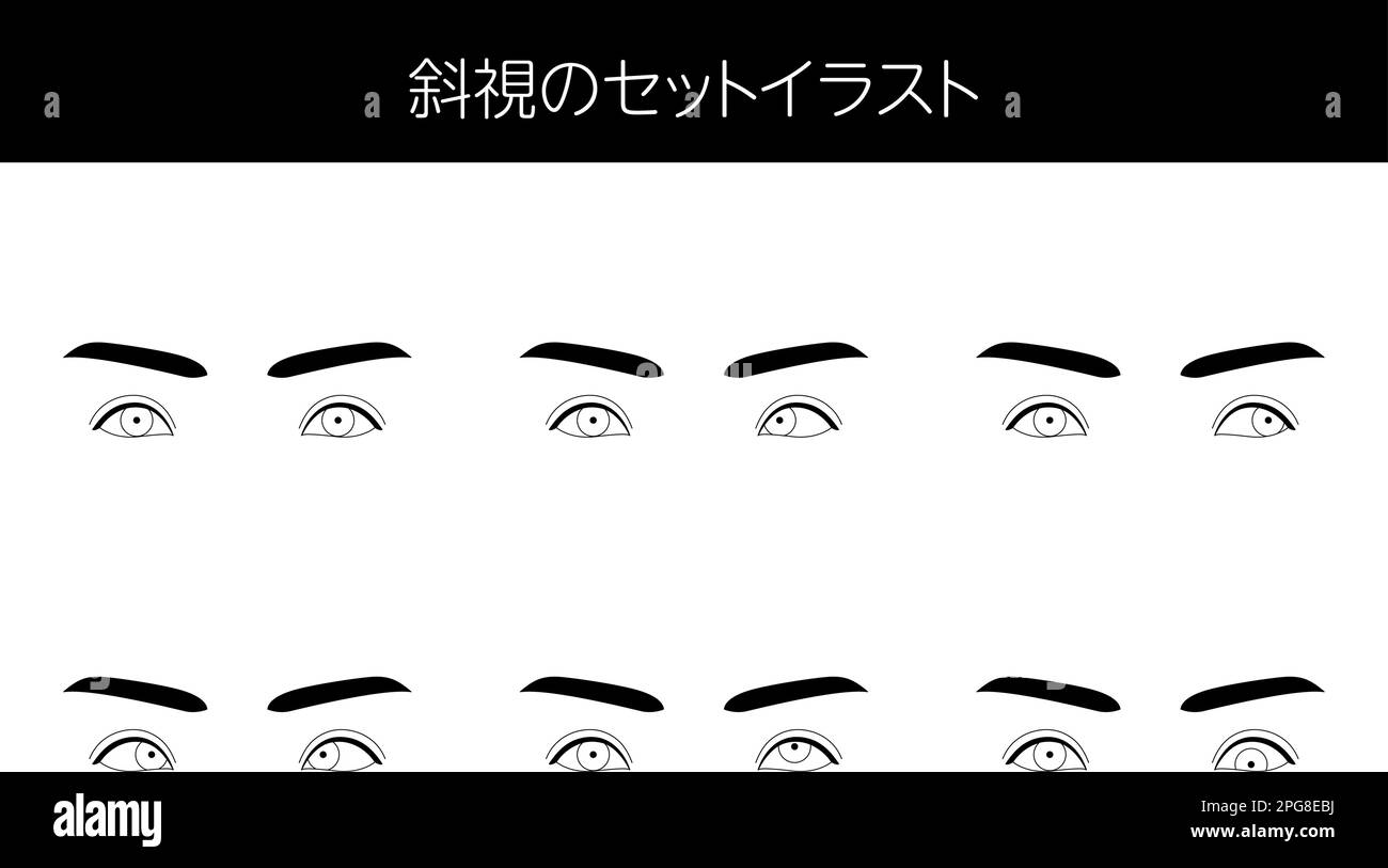 Medical illustration, Illustrative set eye diseases and strabismus ...