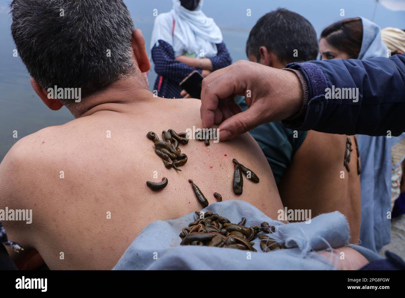 Leeches on back hi-res stock photography and images - Alamy