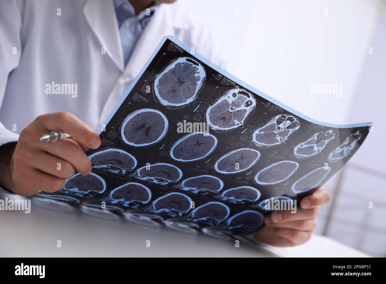 Doctor examining MRI images of patient with multiple sclerosis at table ...