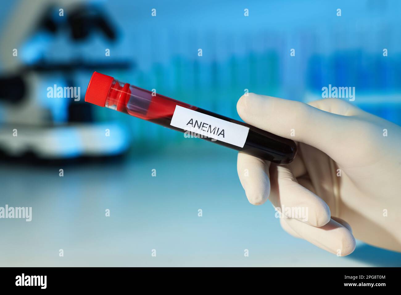 Scientist holding test tube with blood sample and label Anemia on ...