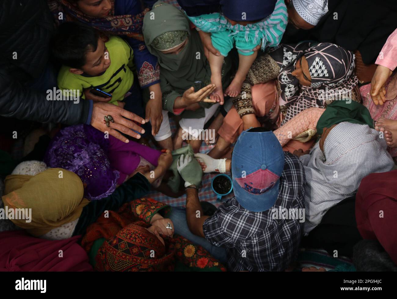 March 21, 2023, Srinagar Kashmir, India: Persons undergo a leech ...