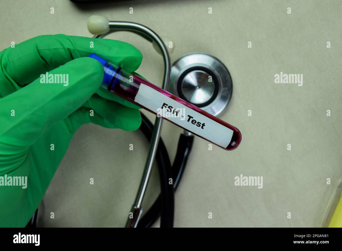 Concept of FSH - Test with blood sample. Healthcare or medical concept ...