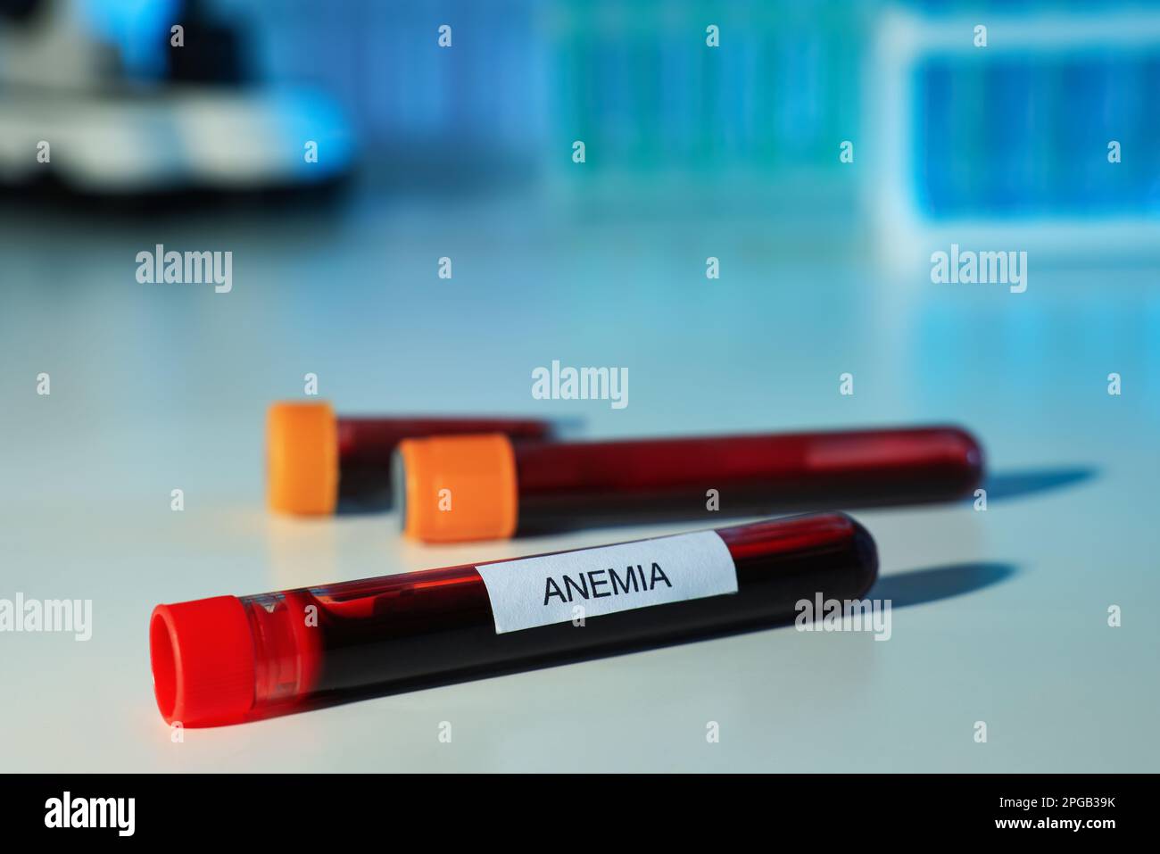 Test tubes with blood samples and label Anemia on white table against ...