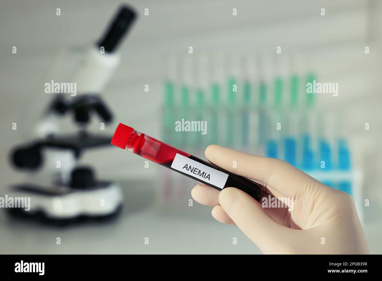 Scientist holding test tube with blood sample and label Anemia on ...