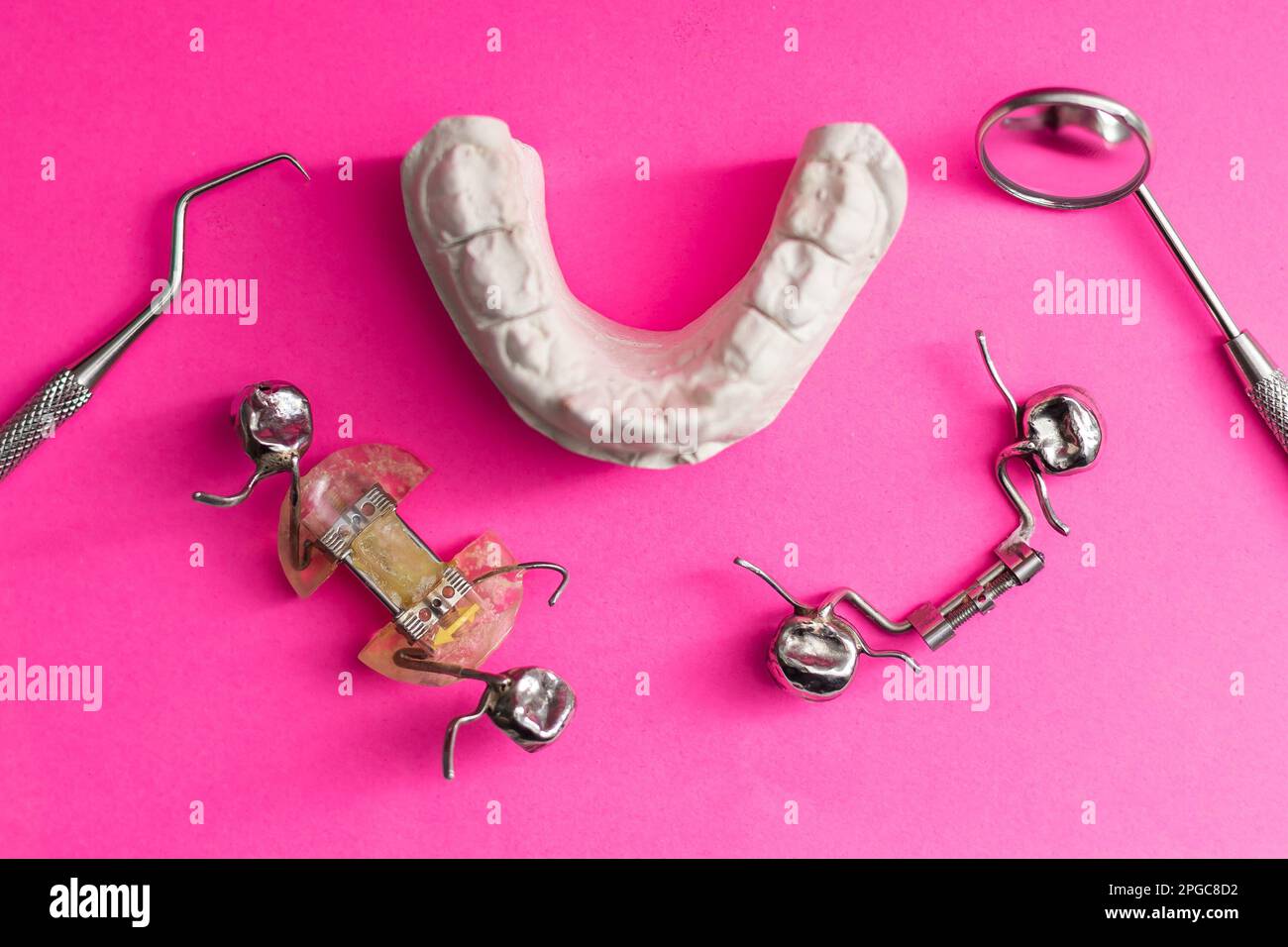 Dental models top view. Jaw models with different problems. Treatment ...