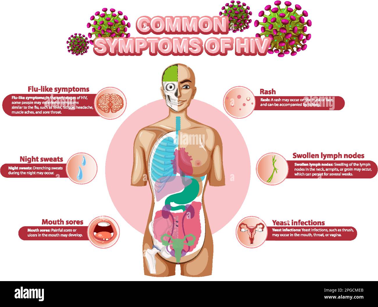 Informative Poster Of Common Symptoms Of Hiv Illustration Stock Vector Image And Art Alamy