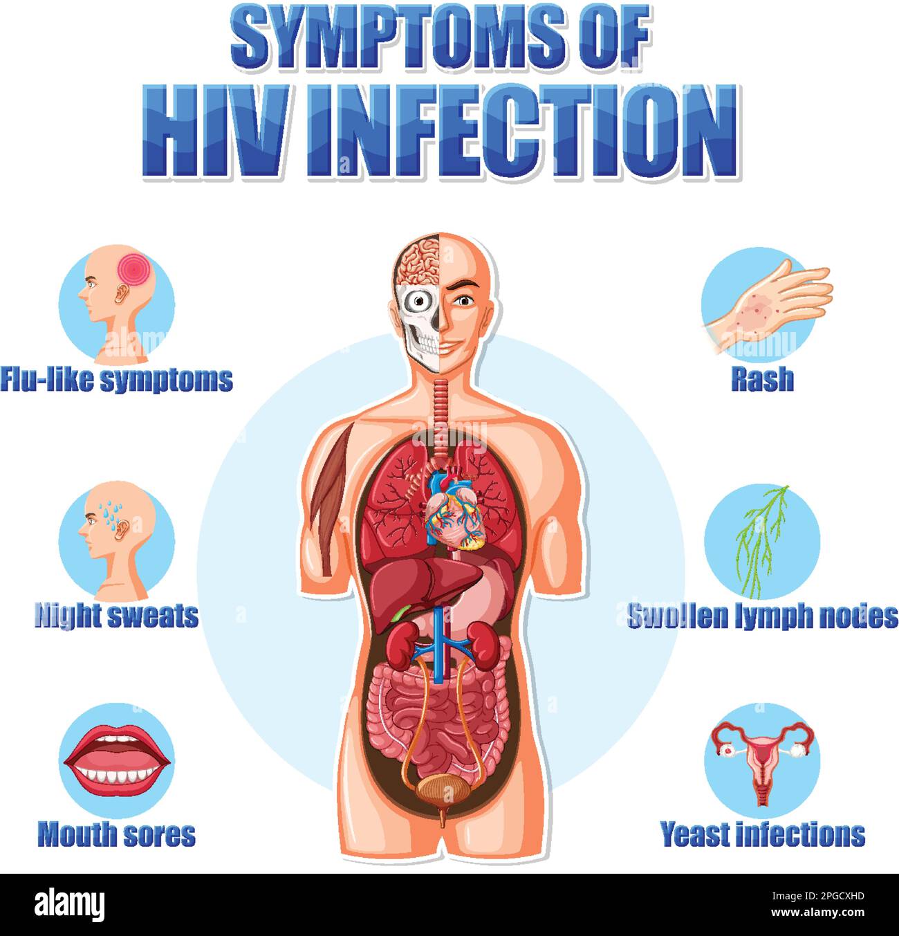 Informative Poster Of Main Symptoms Of Hiv Illustration Stock Vector