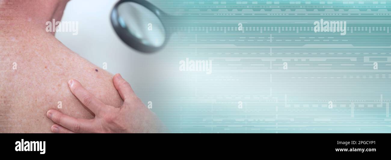 Dermatologist examining skin of patient shoulder with magnifying glass ...