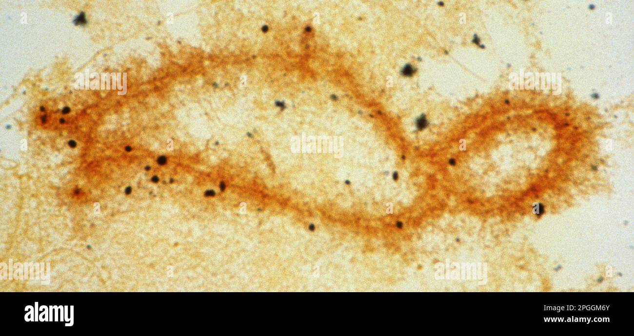 Crossing over during meiosis, light micrograph Stock Photo - Alamy