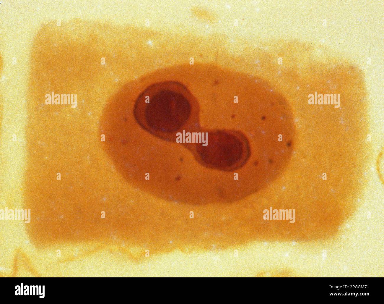 Segregated nucleolus, light micrograph Stock Photo - Alamy