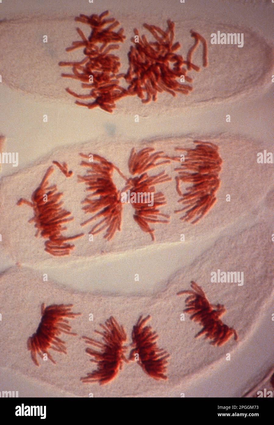 Mitosis in binucleate cells, light micrograph Stock Photo - Alamy