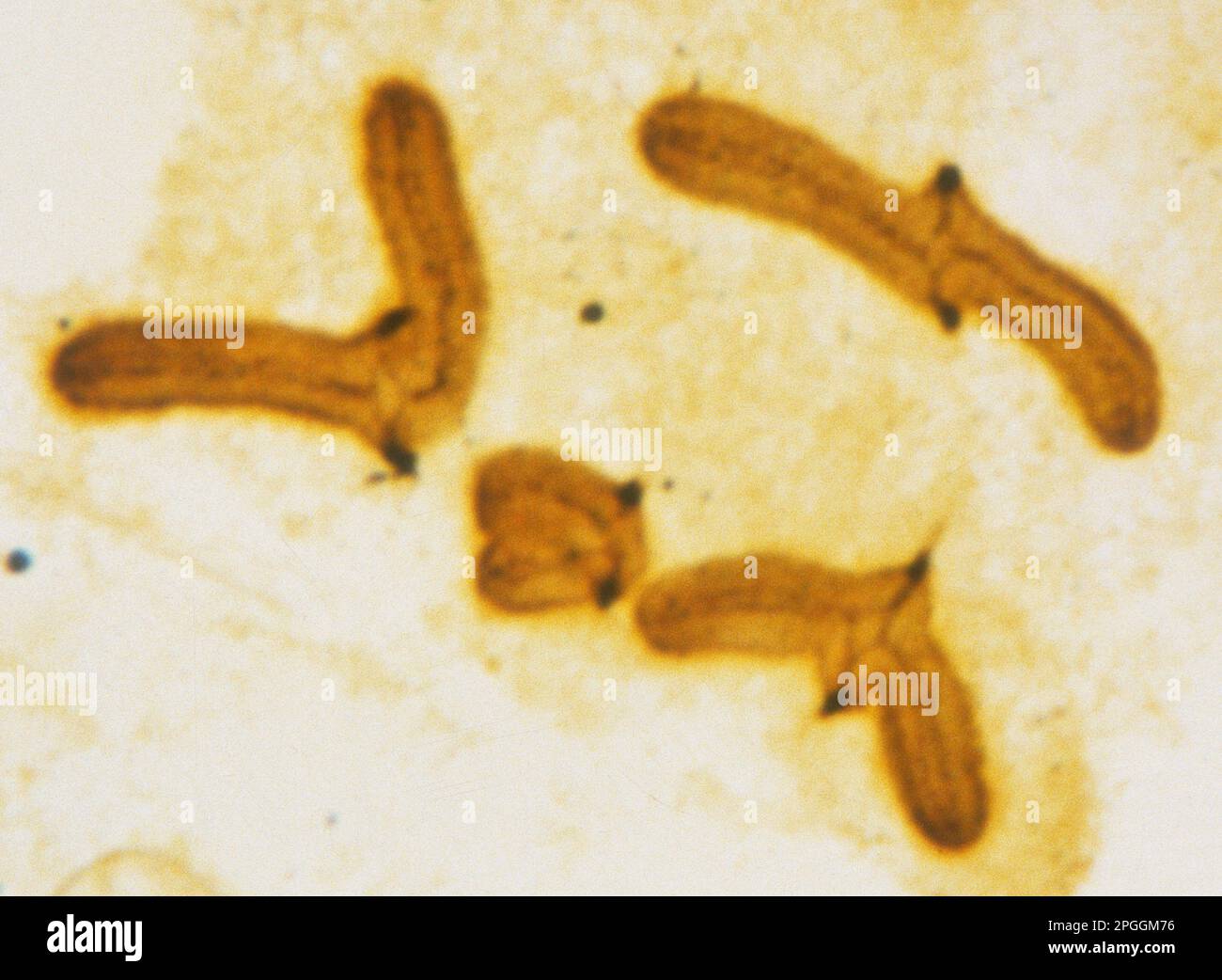 Crossing over during meiosis, light micrograph Stock Photo - Alamy