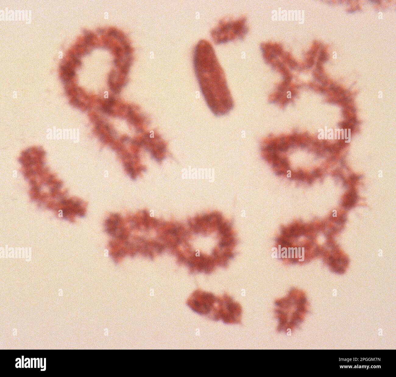 Crossing over during meiosis, light micrograph Stock Photo - Alamy