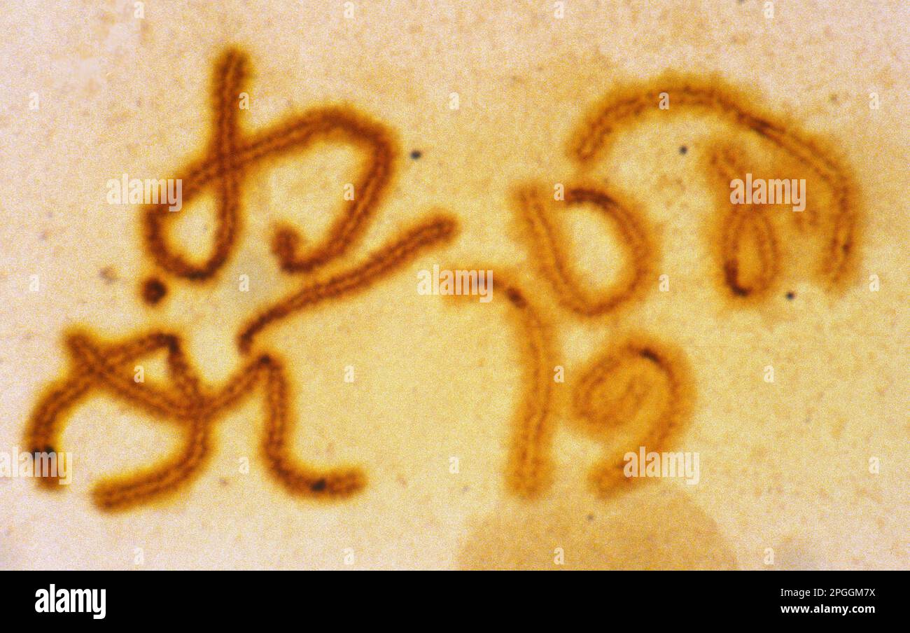 Mitosis, light micrograph Stock Photo - Alamy