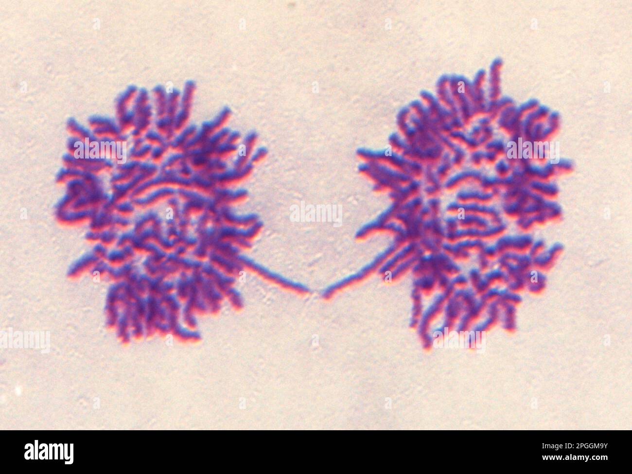 Mitosis, light micrograph Stock Photo - Alamy