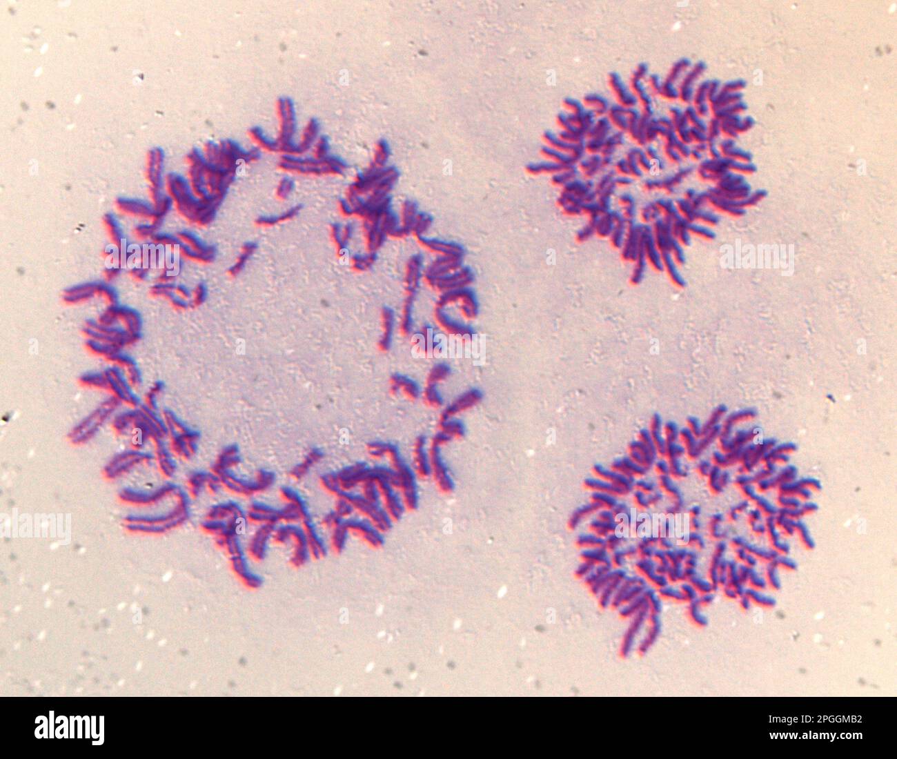 Mitosis, light micrograph Stock Photo - Alamy