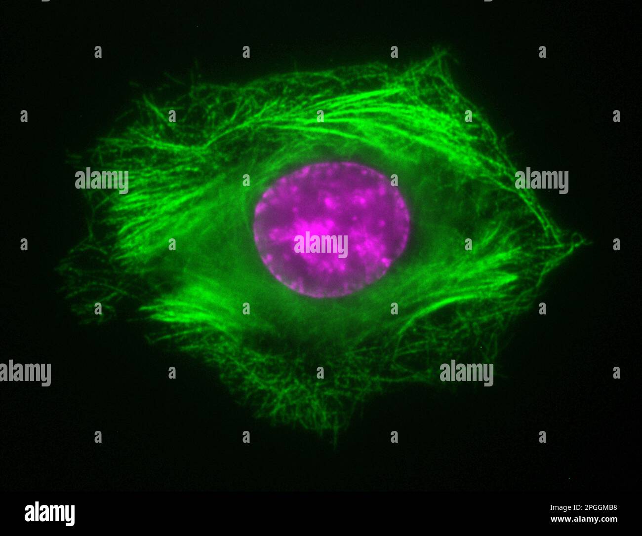 Interphase cell treated with Taxol, light micrograph Stock Photo - Alamy