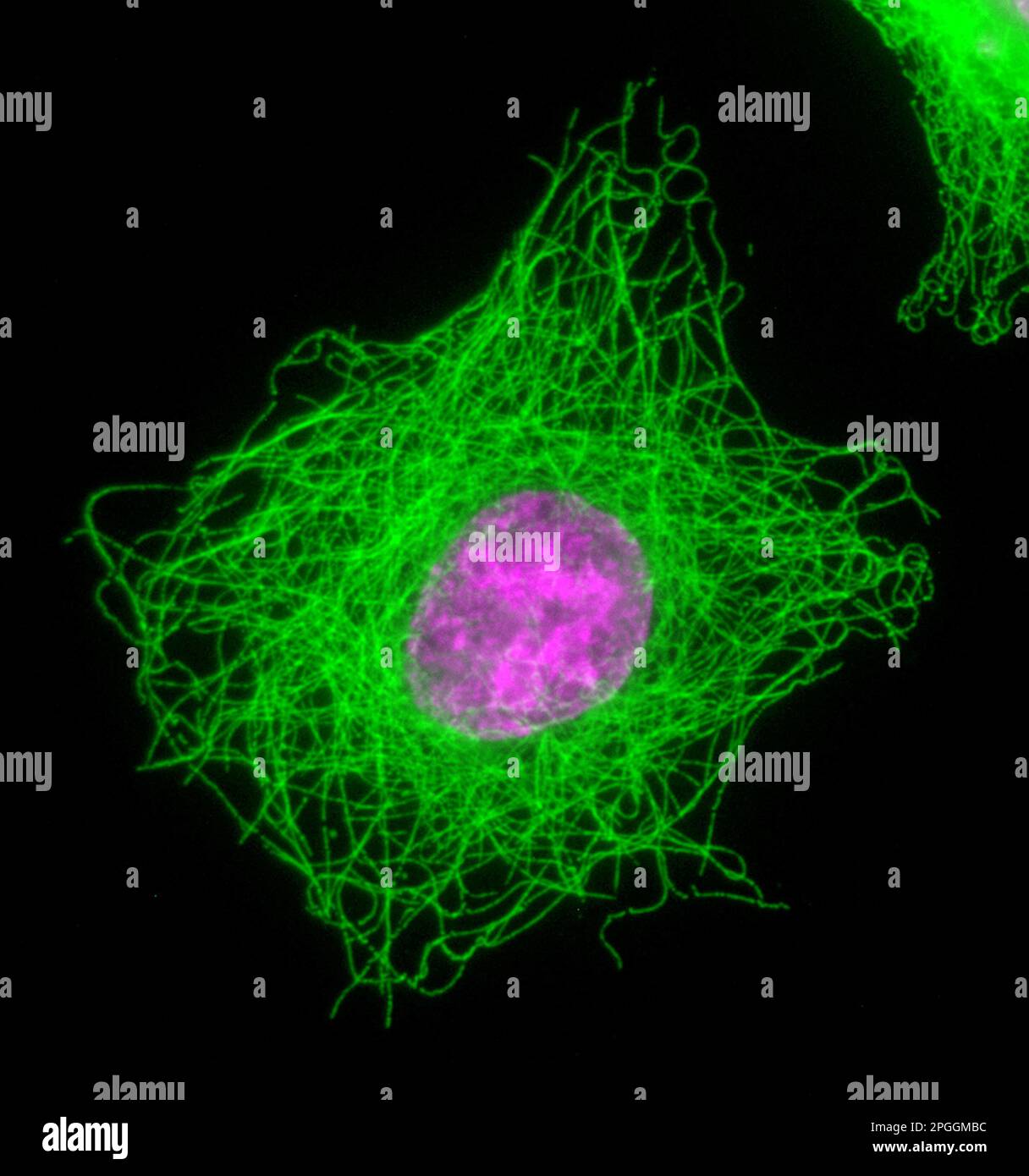 Mitosis, light micrograph Stock Photo - Alamy