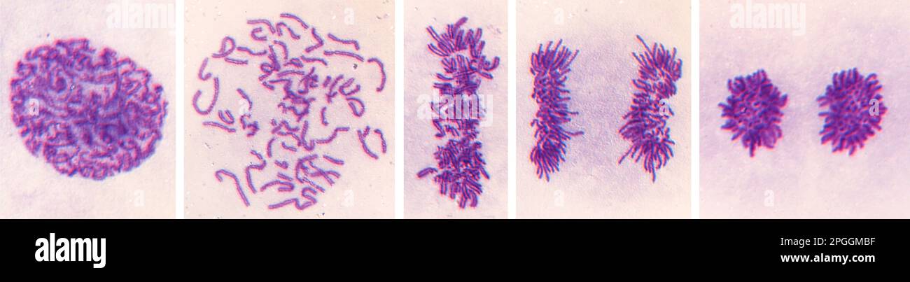Mitosis, light micrograph Stock Photo - Alamy