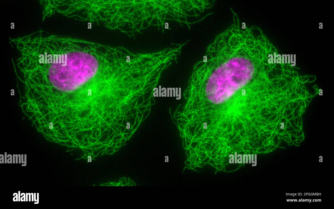 Mitosis, light micrograph Stock Photo - Alamy