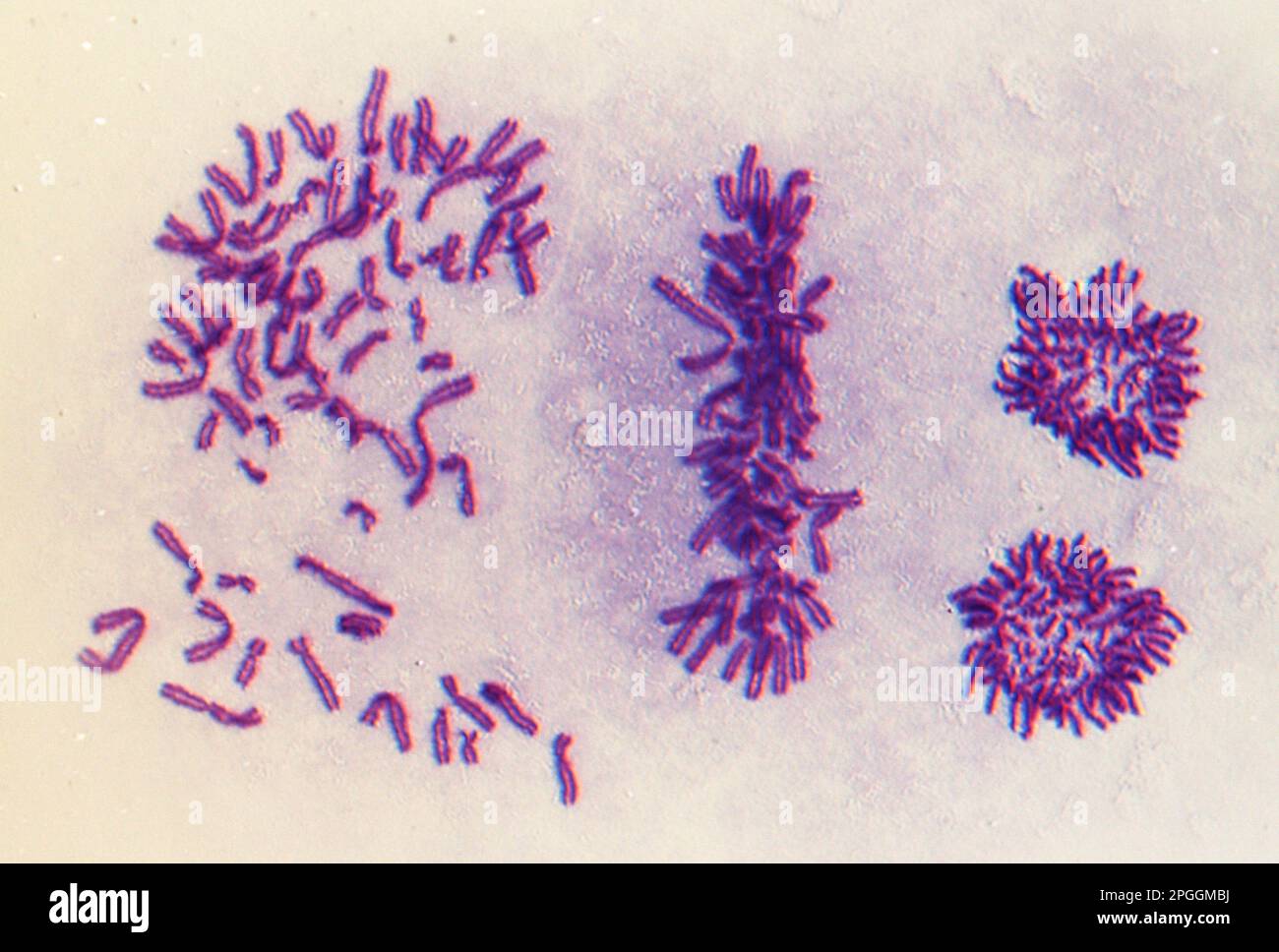 Mitosis, light micrograph Stock Photo - Alamy