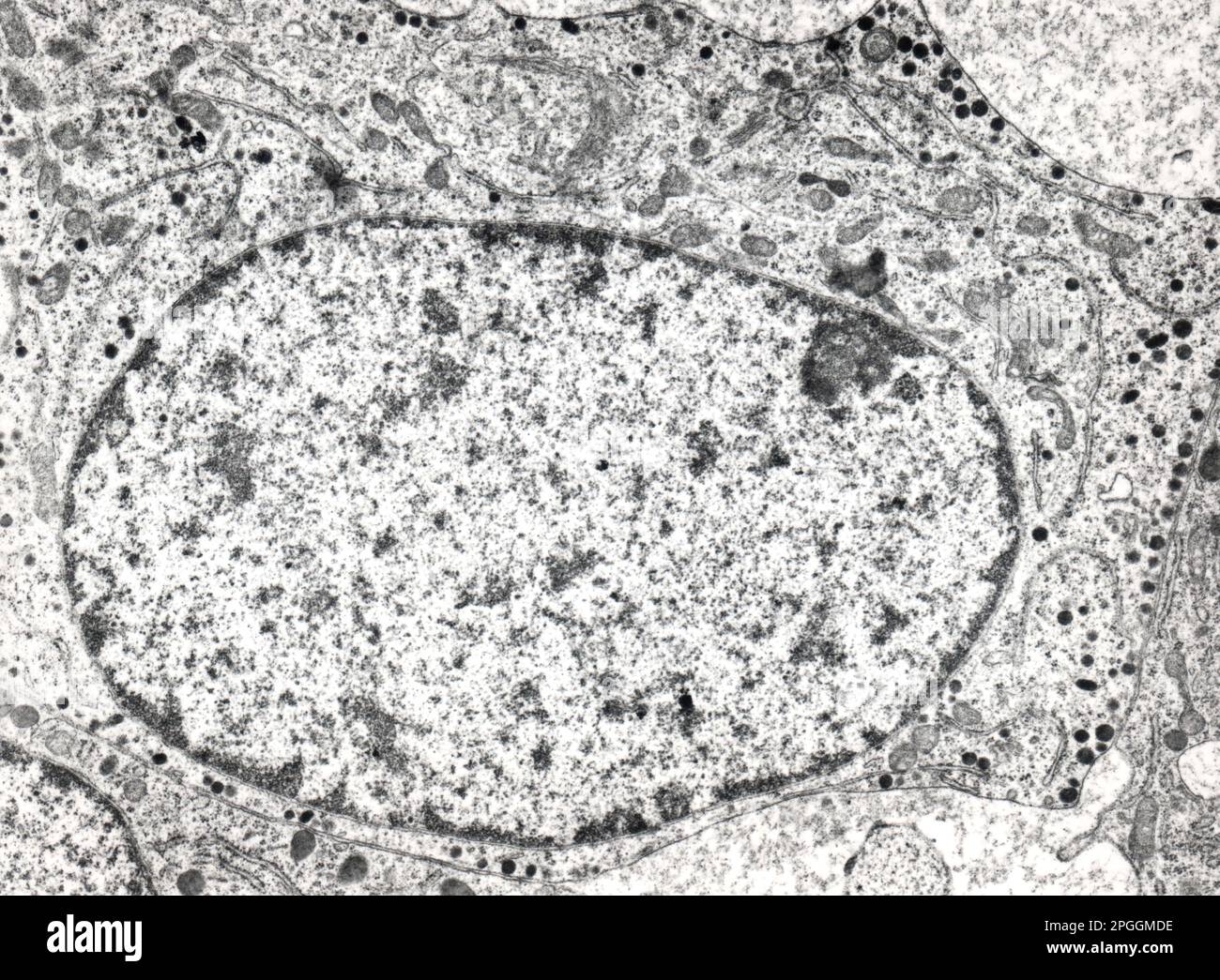 Thyrotropic cell in anterior pituitary gland, TEM Stock Photo - Alamy