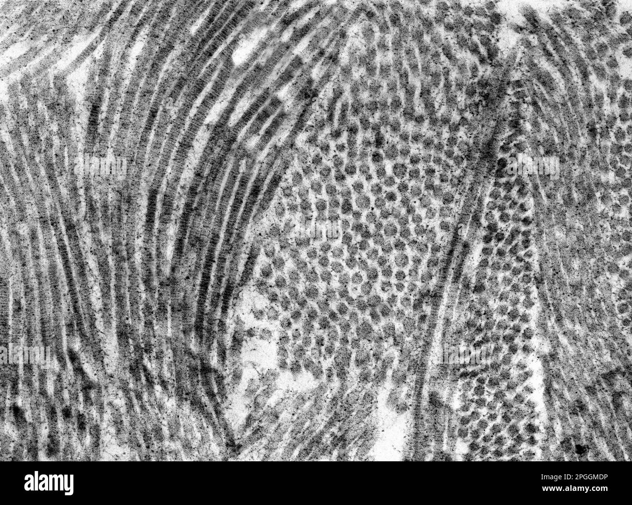 Collagen fibrils, TEM Stock Photo - Alamy