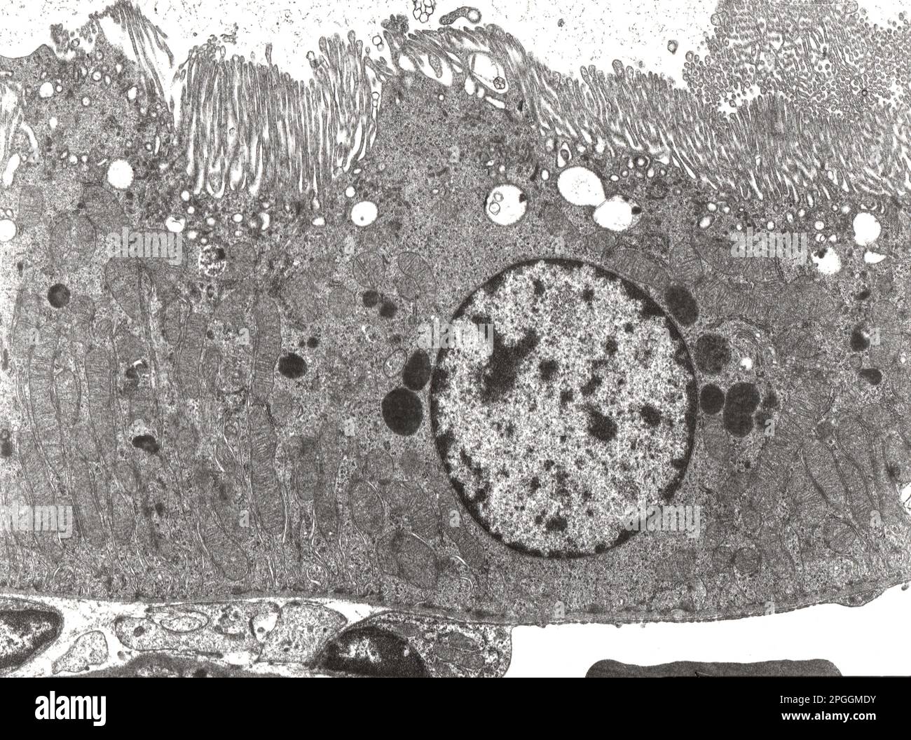 Kidney proximal convoluted tubule, TEM Stock Photo - Alamy