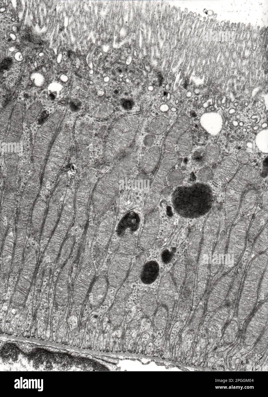 Kidney proximal convoluted tubule, TEM Stock Photo - Alamy