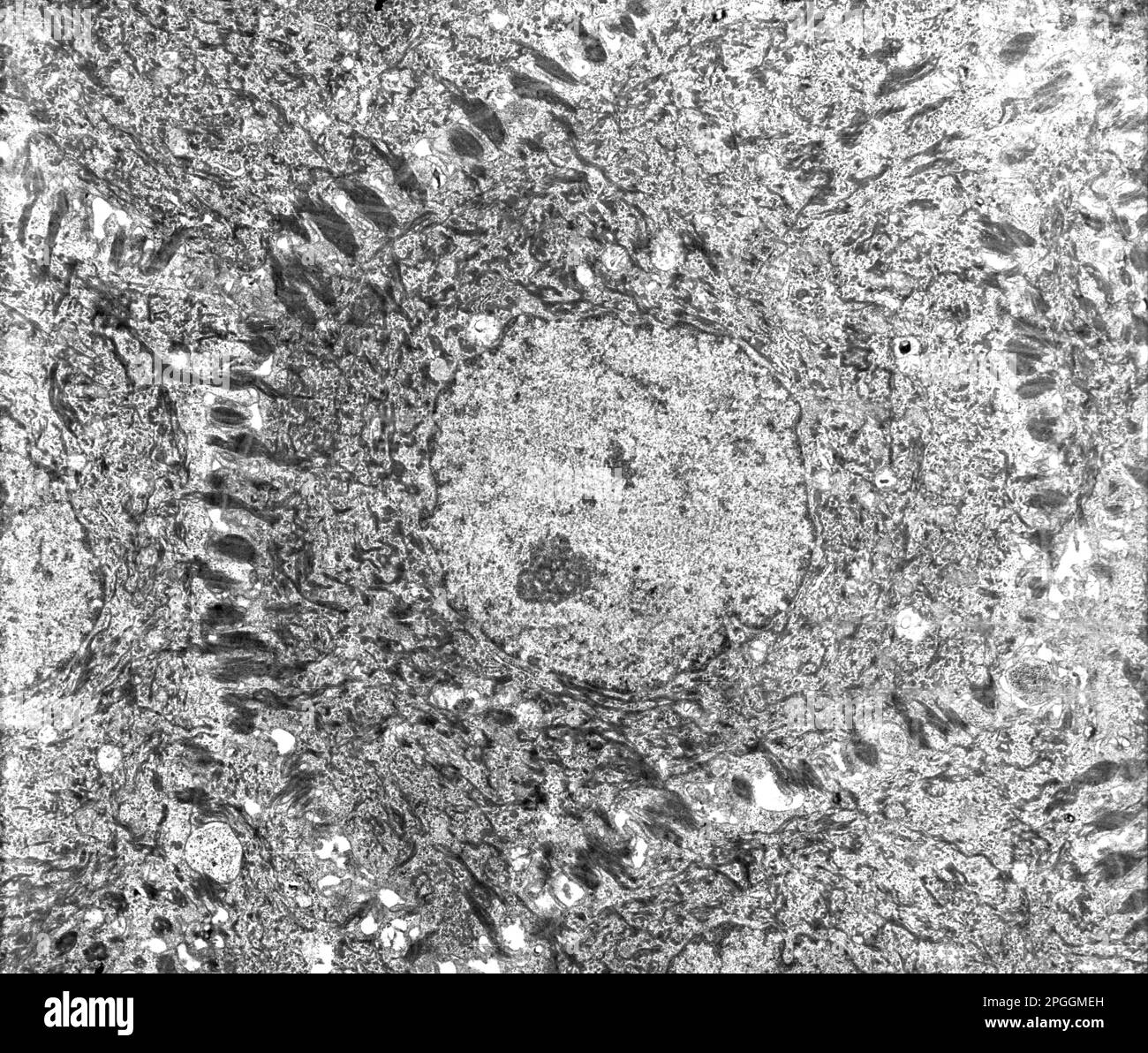 Epidermis spinous layer keratinocyte, TEM Stock Photo - Alamy