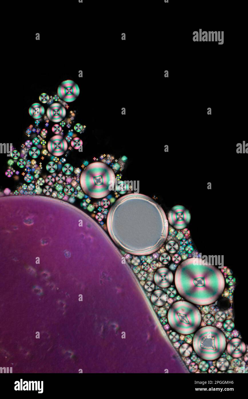 Droplets of liquid crystal, light micrograph Stock Photo - Alamy