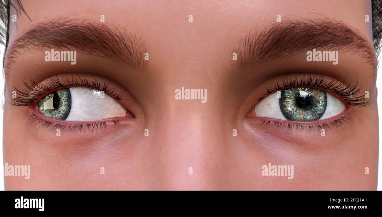 Outward deviation hi-res stock photography and images - Alamy