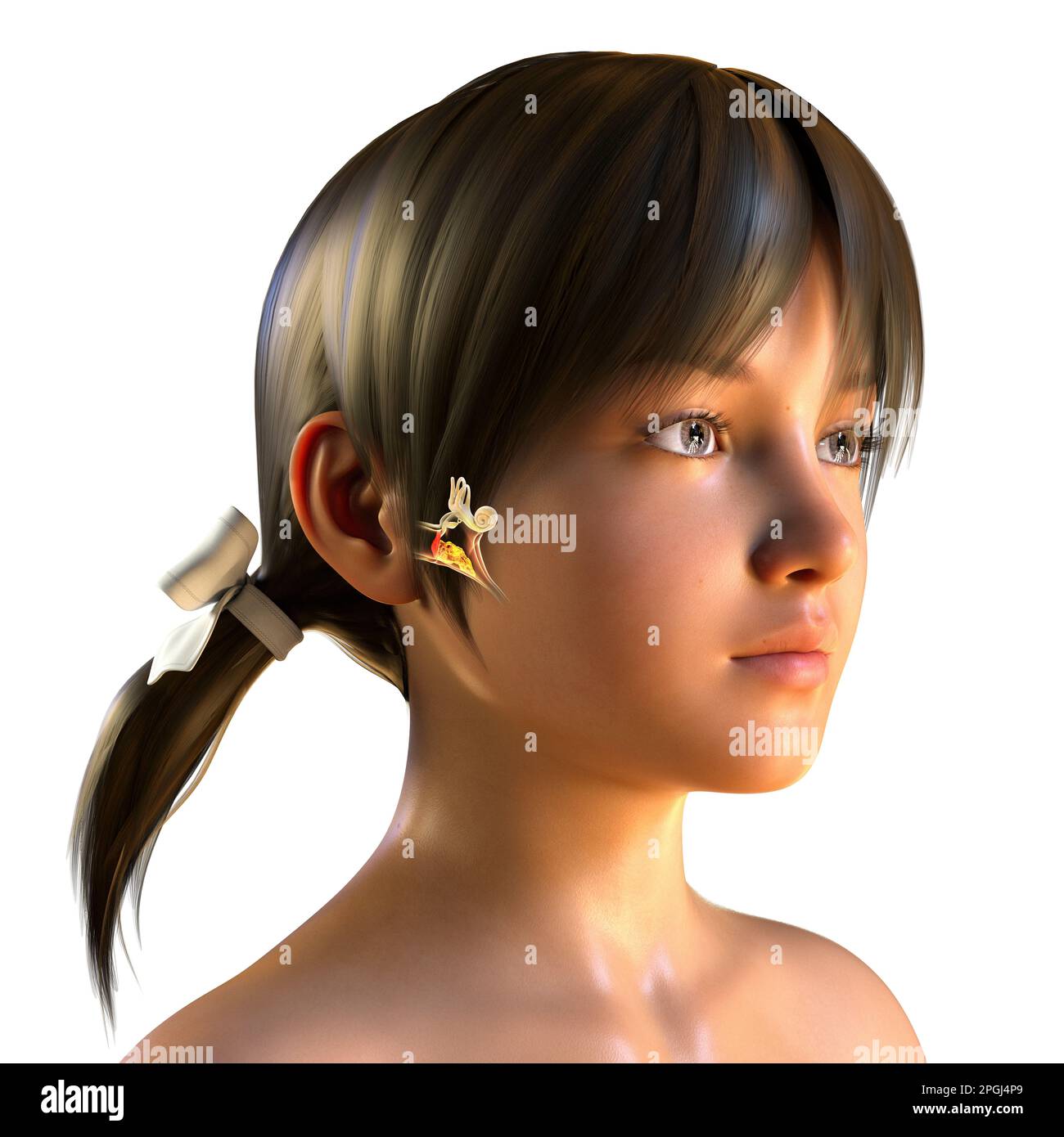 Chronic suppurative otitis hi-res stock photography and images - Alamy