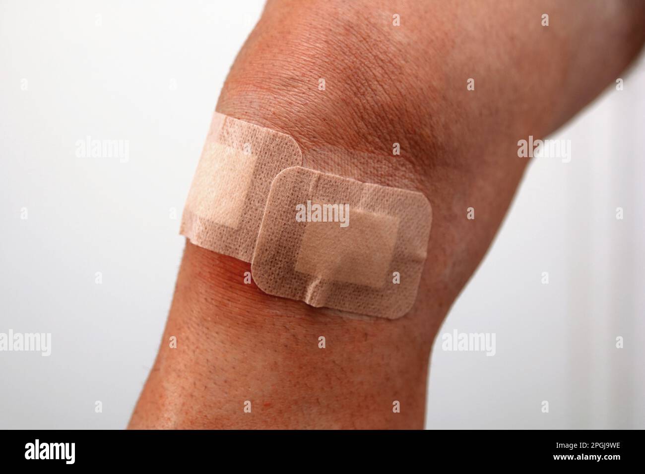 madical tapes on wound sutures after a knee surgery, meniscus repair ...