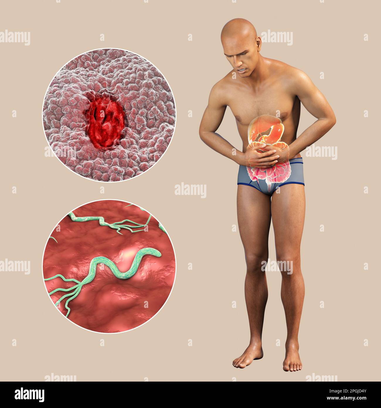 Hélicobacter pylori hi-res stock photography and images - Alamy
