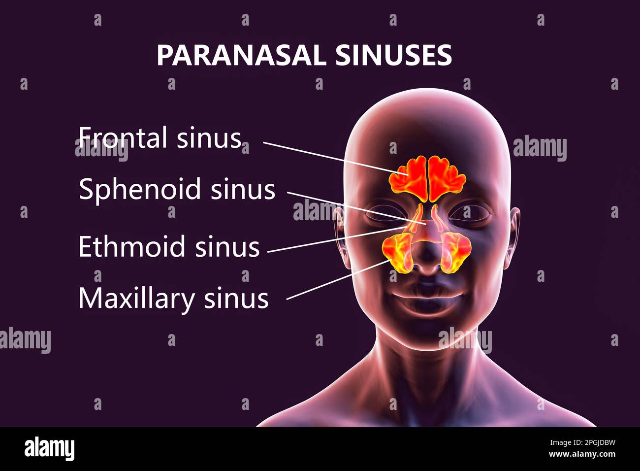 Facial Bones Of Paranasal Sinuses at Alexis Dawkins blog