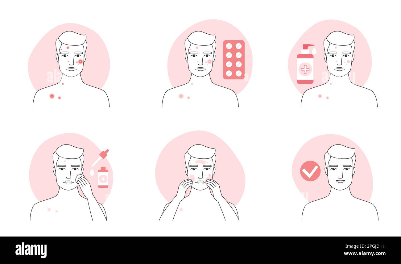 Acne treatment for man infographic line icon set vector illustration ...