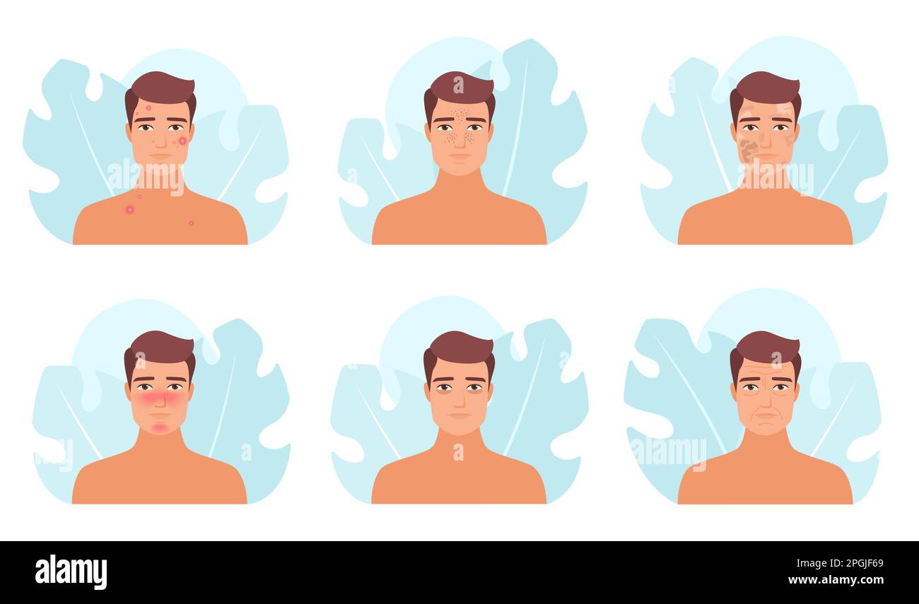Male skin problem set vector illustration. Cartoon man with different ...