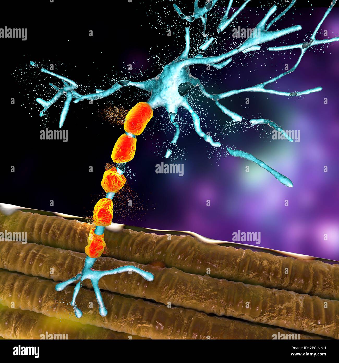 Degradation of motor neurons hi-res stock photography and images - Alamy