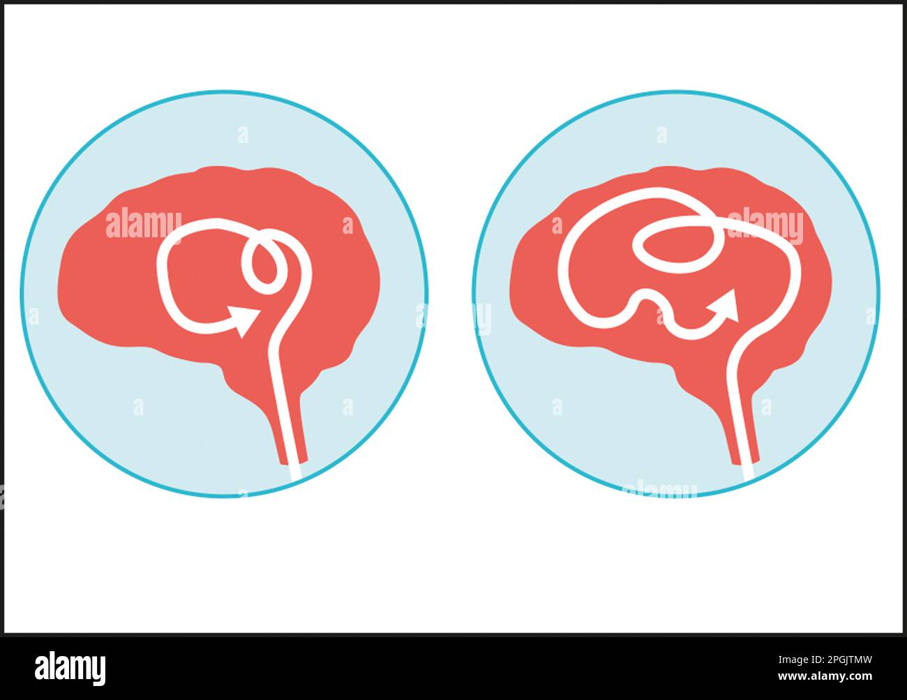 Different neural pathways Stock Photo - Alamy Different neural pathways Stock Photo - Alamy