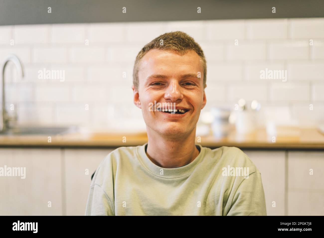 Portrait of young man handicapped with disabilities. Optimistic smiling ...