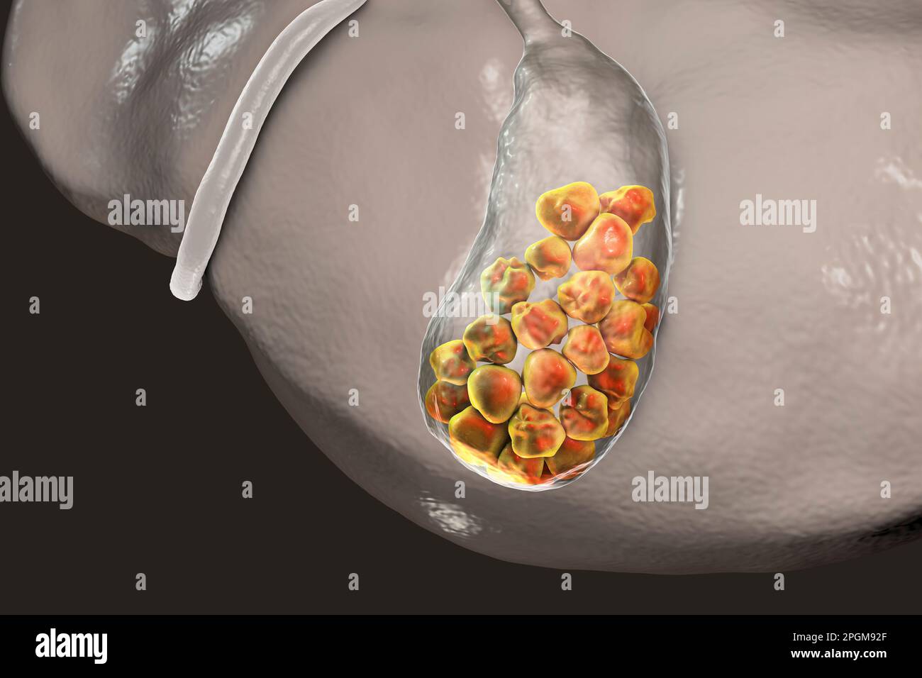 Fluid bladder hi-res stock photography and images - Alamy