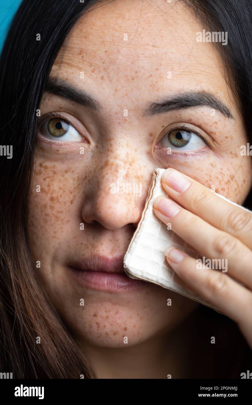 Woman with freckles cleaning face with makeup wipe Stock Photo - Alamy