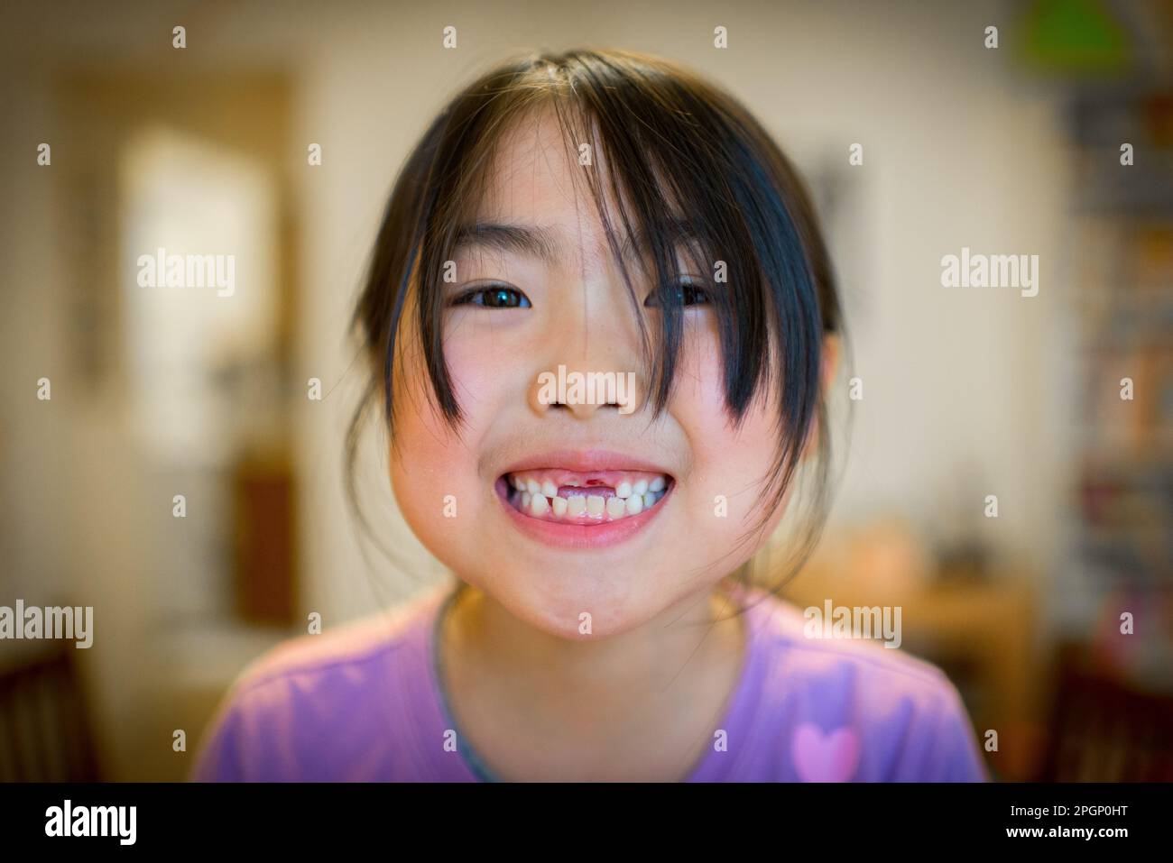 Young asian girl losing front two baby teeth Stock Photo - Alamy